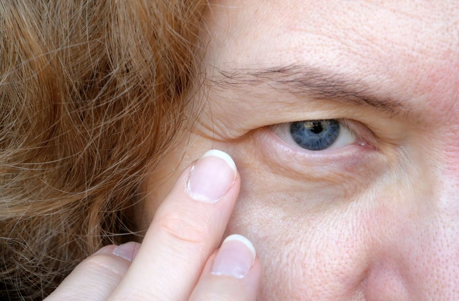 Can Amblyopia (Lazy Eye) Be Treated in Adults? - Total Vision Care ...